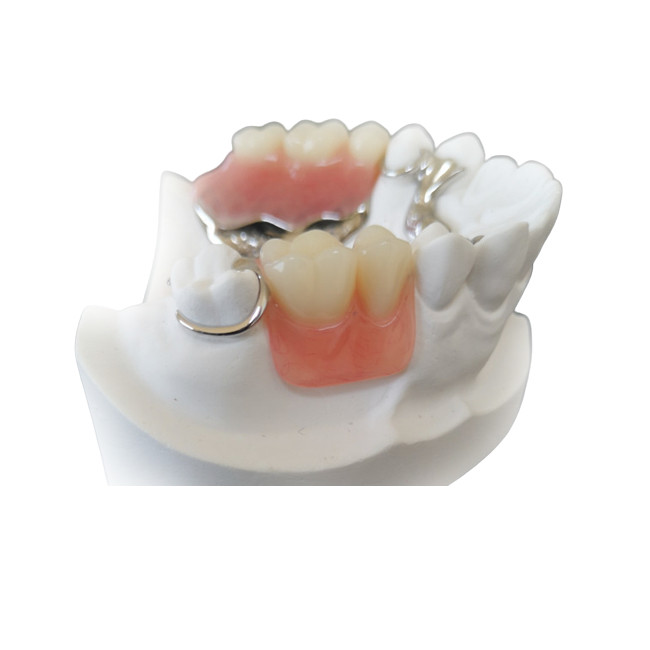 맞춘 평활 표면 CAD 캠 PFM 크라운 브리지 고해상도